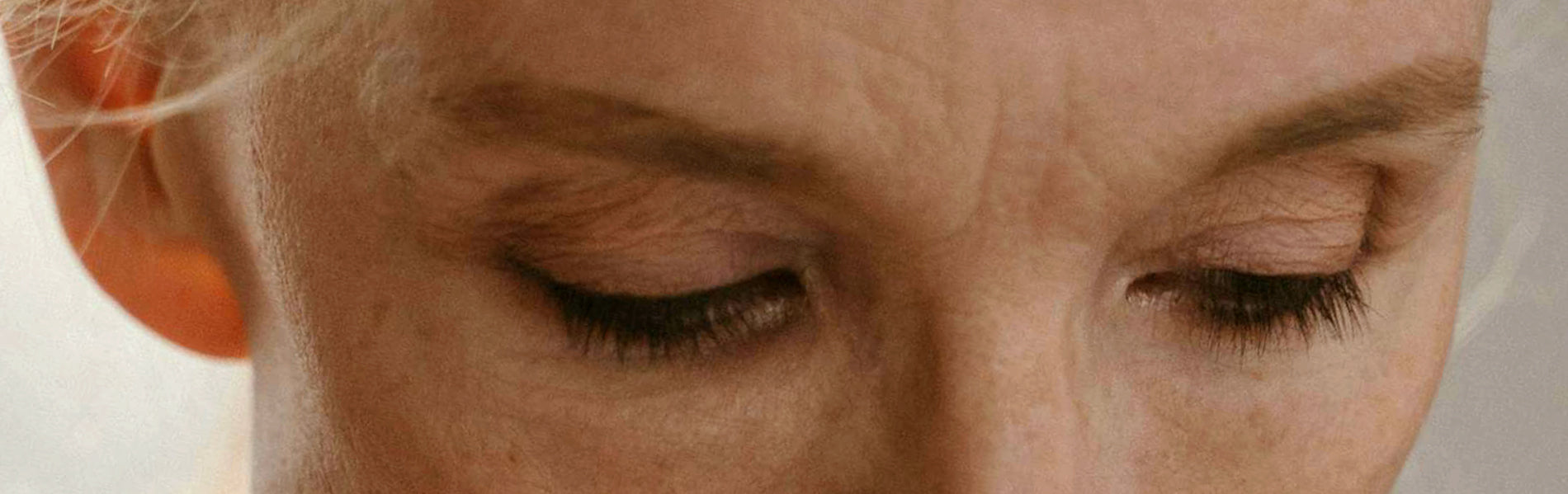 Understanding Collagen Loss: Causes, Effects, and Solutions | Project E ...